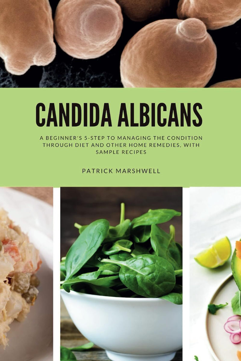 Candida Albicans A Beginner's 5-step Guide To Managing The Condition ...